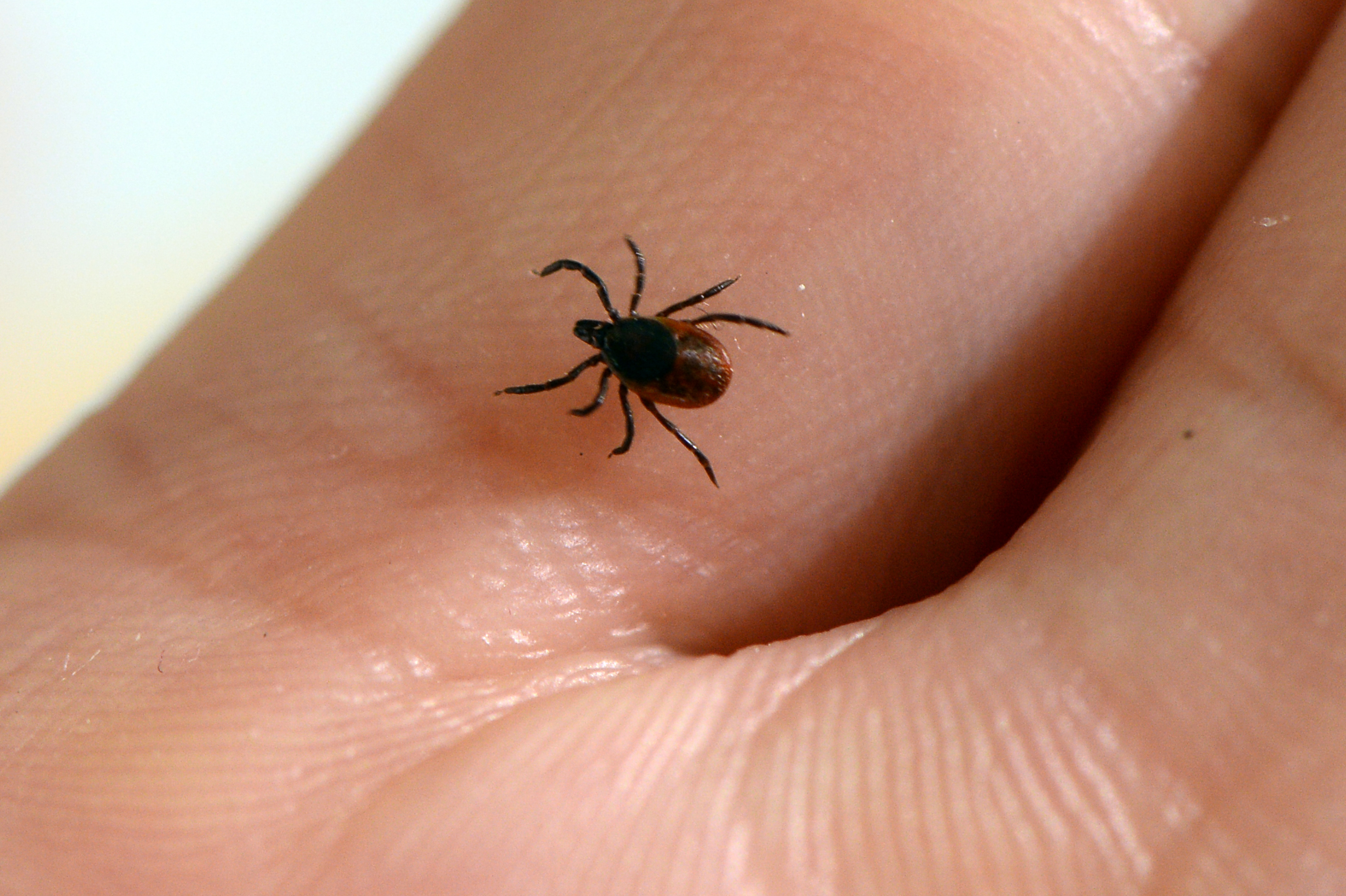 Health experts recommend using tweezers to remove ticks | Fact Check