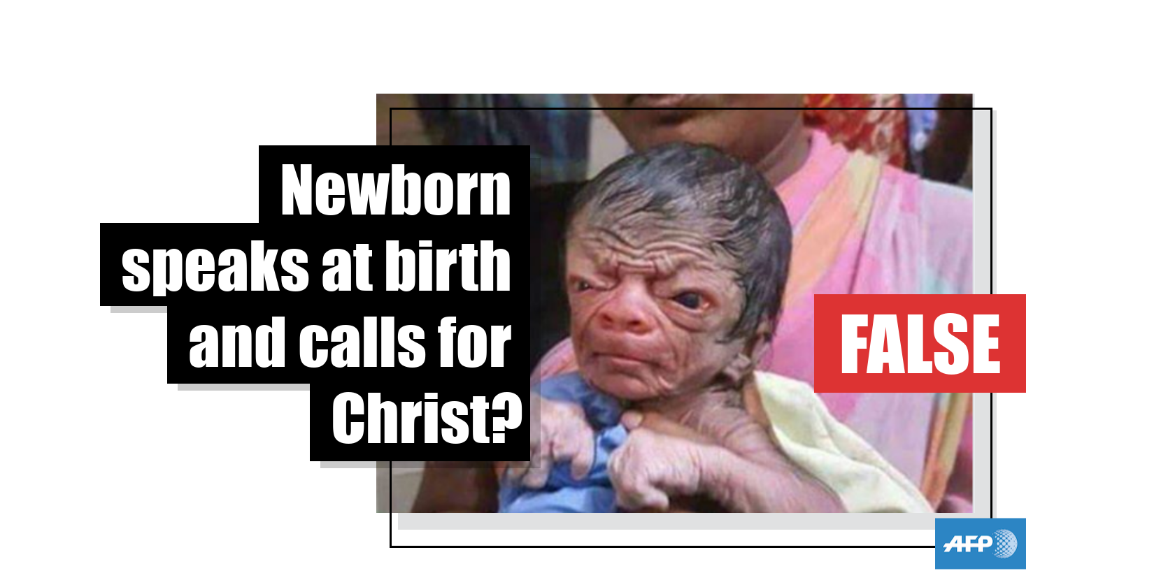 This baby with progeria syndrome did not speak at birth | Fact Check