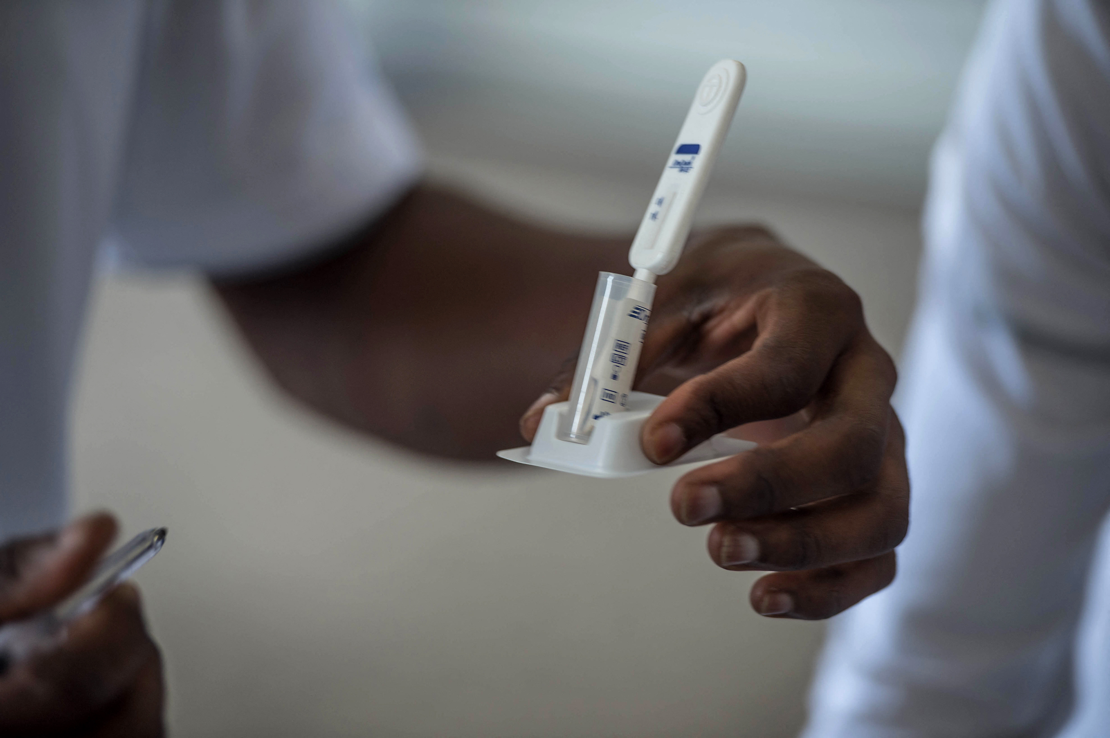 A regular cure for HIV does not exist yet, but early trials are ...