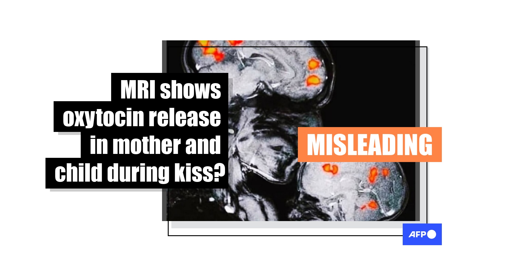 This MRI scan of a mother with her child has been altered | Fact Check