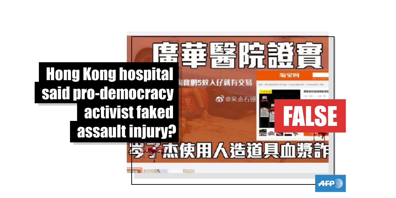 Hong Kong hospital denies saying that pro-democracy activist Jimmy Sham ...