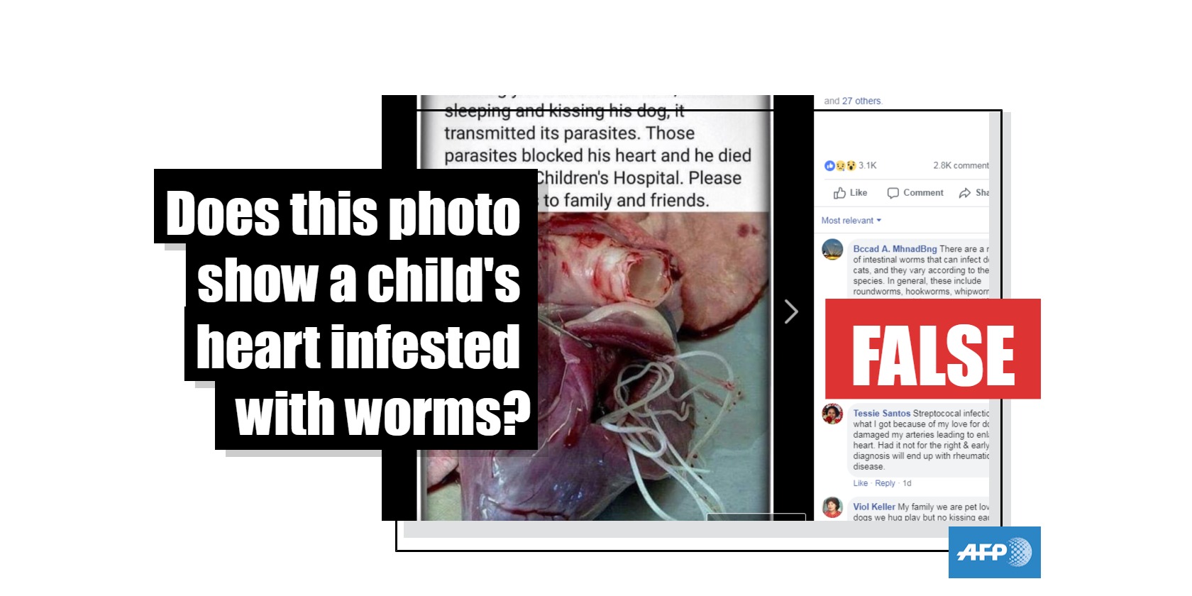 No, this photo does not show a child’s heart infected with parasites ...