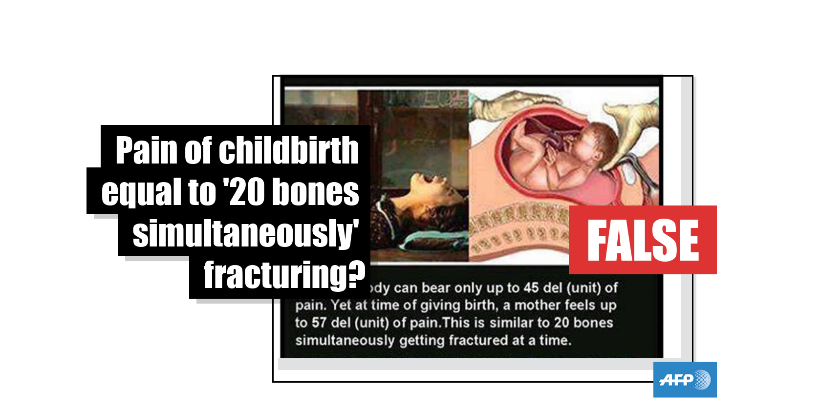 This hoax cites a fictional unit for measuring pain -- health experts ...