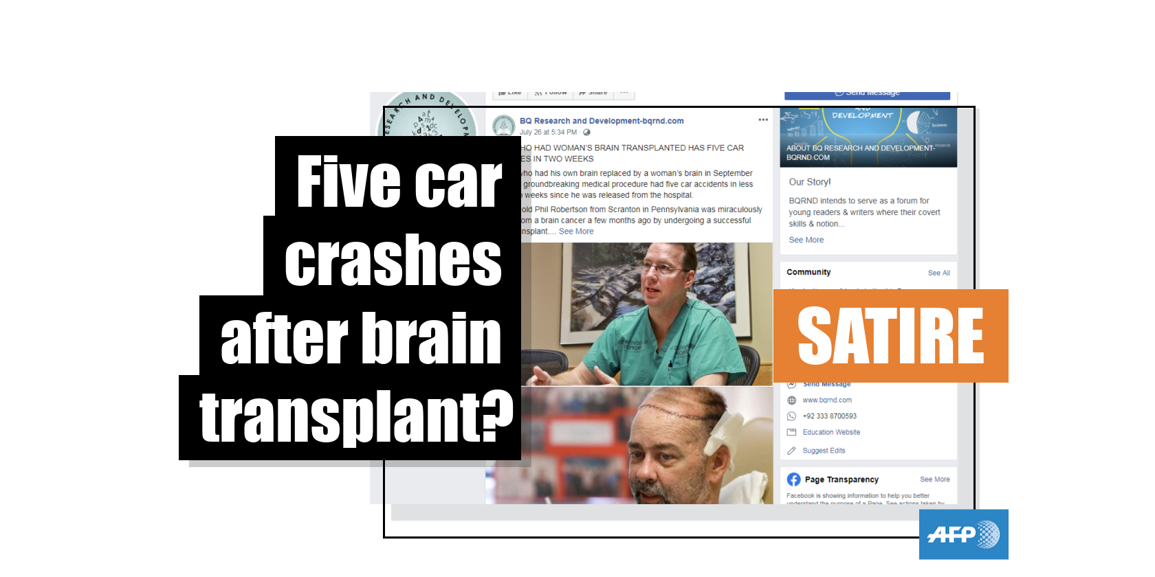 This photo shows a cancer survivor who received a scalp transplant – it ...